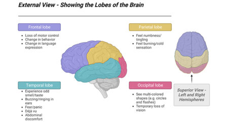 The Neurotypical Brain vs. the Autistic Brain: Brain Structure in ASD