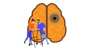 Cerebral Folate Deficiency – An Overview